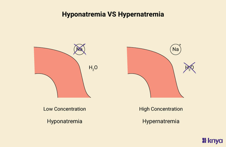 Difference Between Hyponatremia and Hypernatremia Explained! – Knya