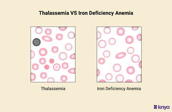 Thalassemia vs Iron Deficiency Anemia | Key Differences Explained! – Knya