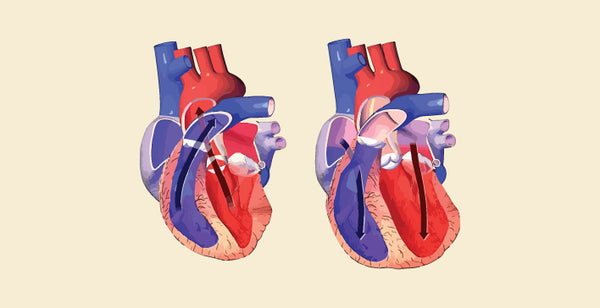 Difference Between Systolic vs Diastolic Heart Failure – Knya Difference Between Systolic vs Diastolic Heart Failure – Knya